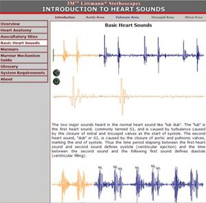 Introduction to Heart Sounds