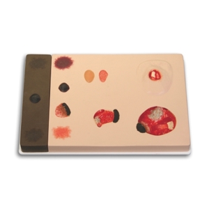 "Pat" Pressure Ulcer Staging Model