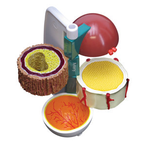 4-Piece Diabetes by GPI Anatomicals